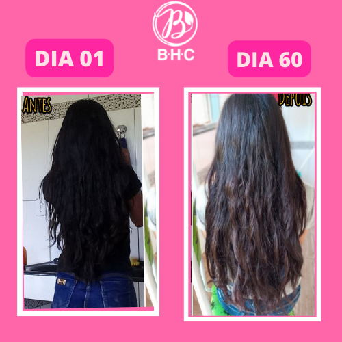 BHC OFICIAL