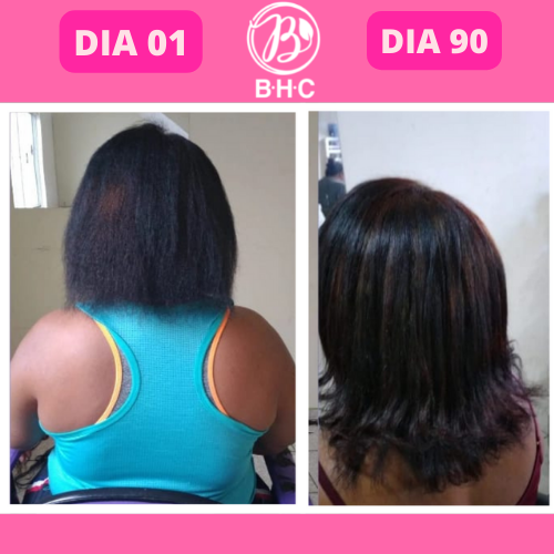 BHC OFICIAL