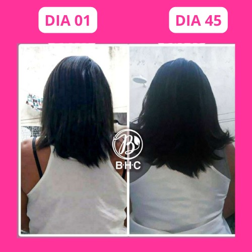 BHC OFICIAL
